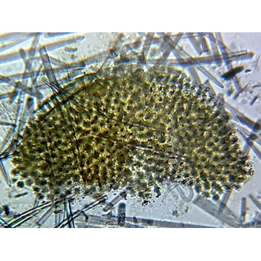 Mixed Pollen Comparison; Typical Dicot Pollens; Whole-mount by Go ...
