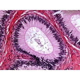 AmScope 40x-2500x Cordless LED Compound Biological Microscope New ...