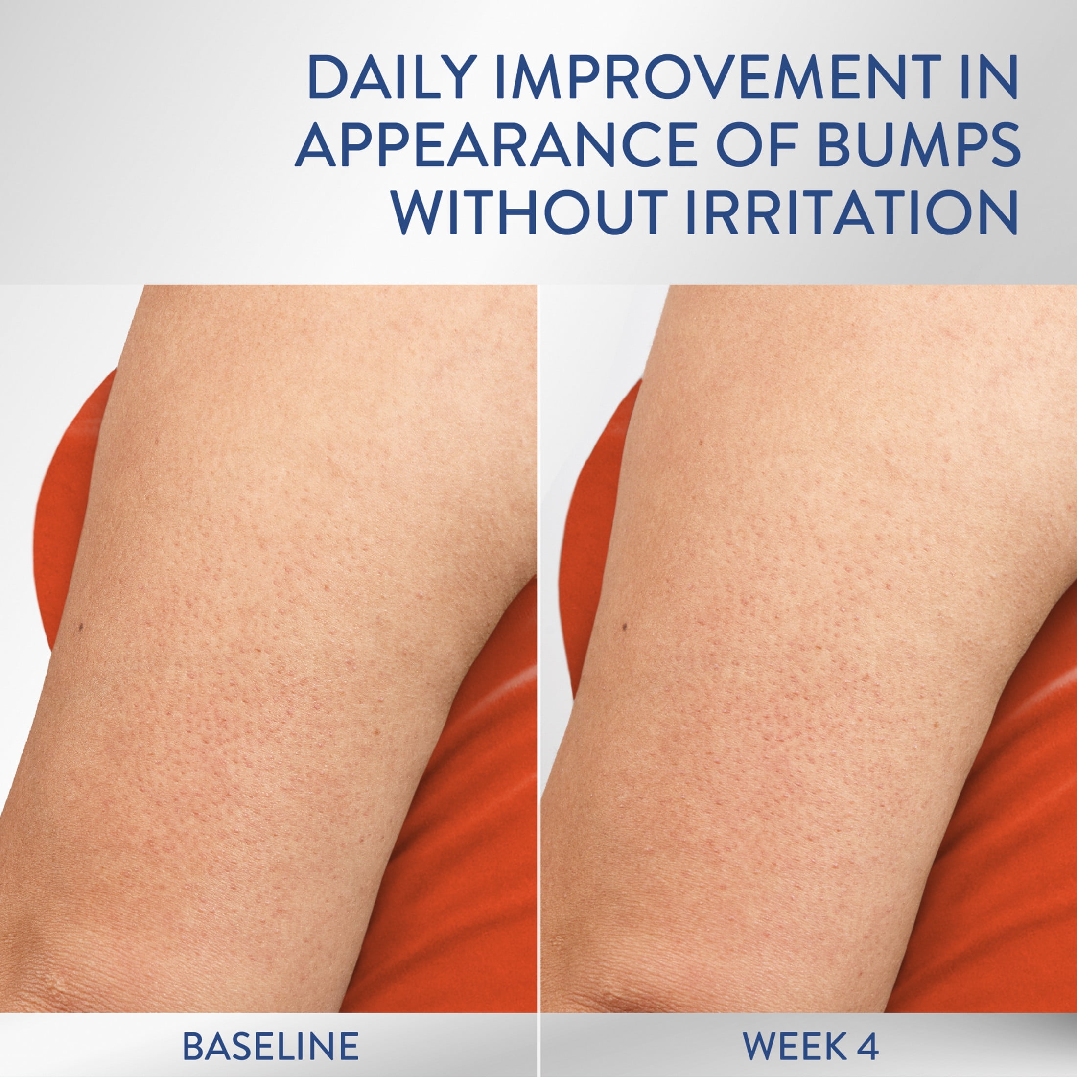 Cetaphil Daily Smoothing Moisturizer for Rough & Australia | Ubuy