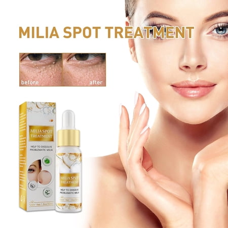 Milia Remover, Milia Spot Treatment Helps Dissolve And Reduce Milia ...