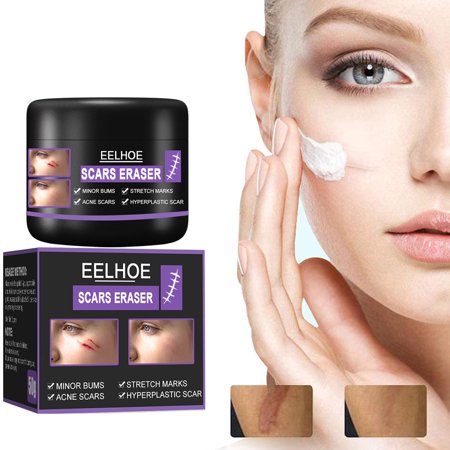 Archer 50g/Box Wound Repair Cream Easily Penetrate Non-irritating ...