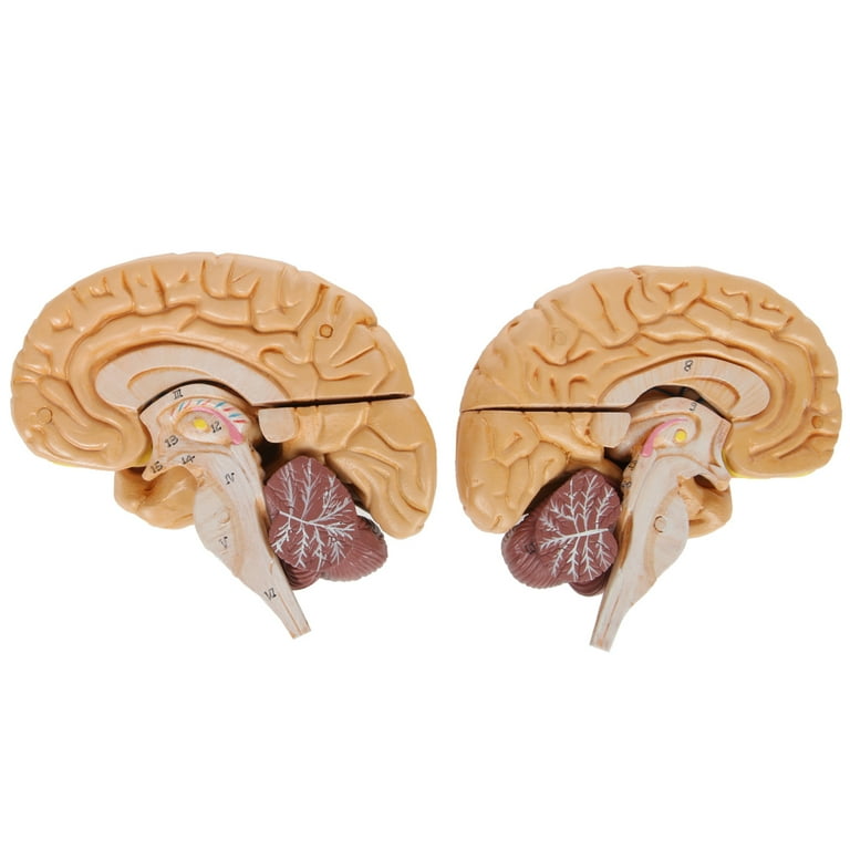 Real Human Brains In Skull
