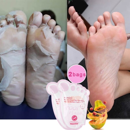 Foot Exfoliating, Remove Dead Skin Foot Masks, Strong Permeability ...