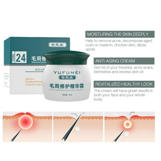 50G Face Body Skin Repair Cream For Curing Keratosis Pilaris/ Chicken ...