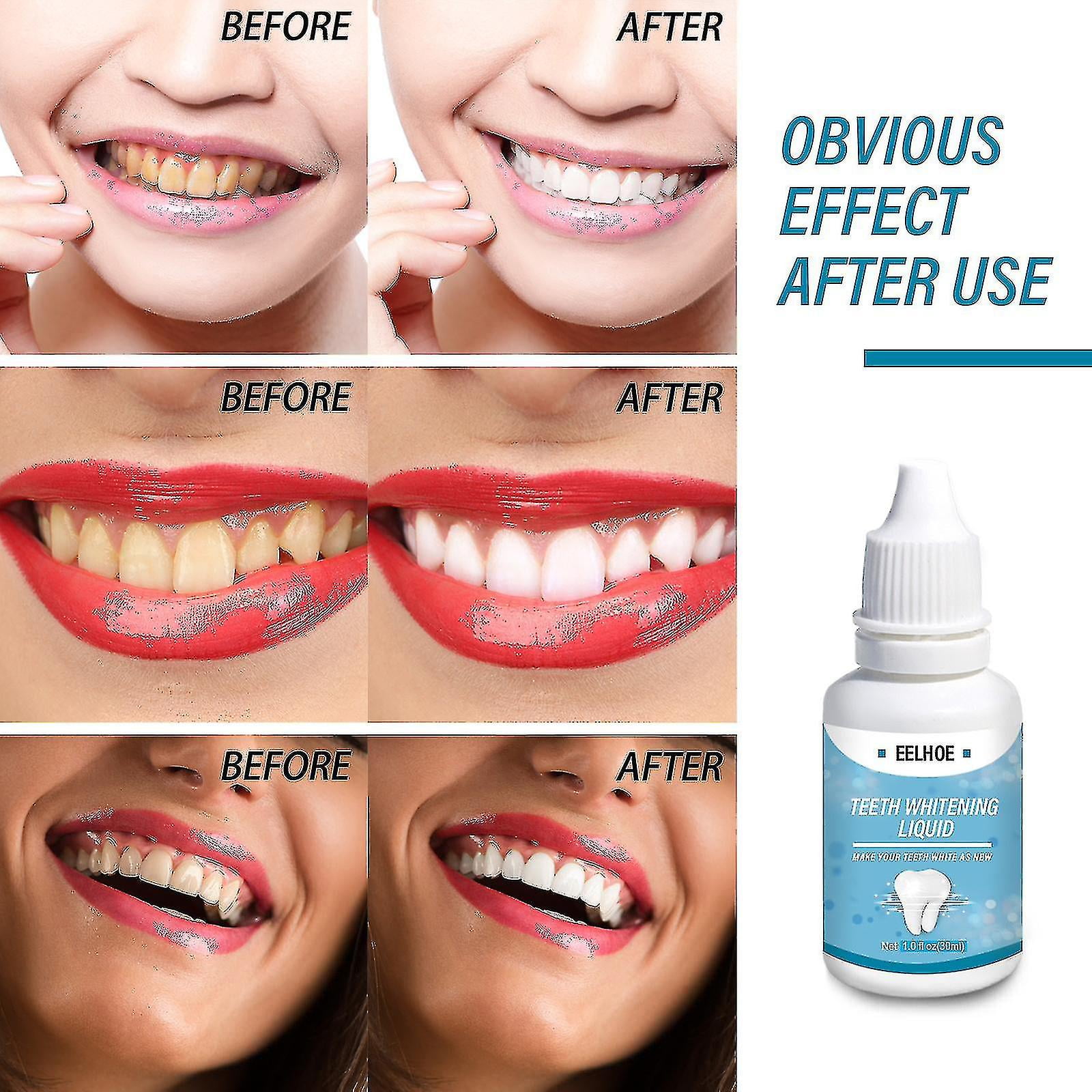 Tooth Whitening Liquid Tooth Liquid Tooth Black Tooth Smoke Tooth Fresh ...
