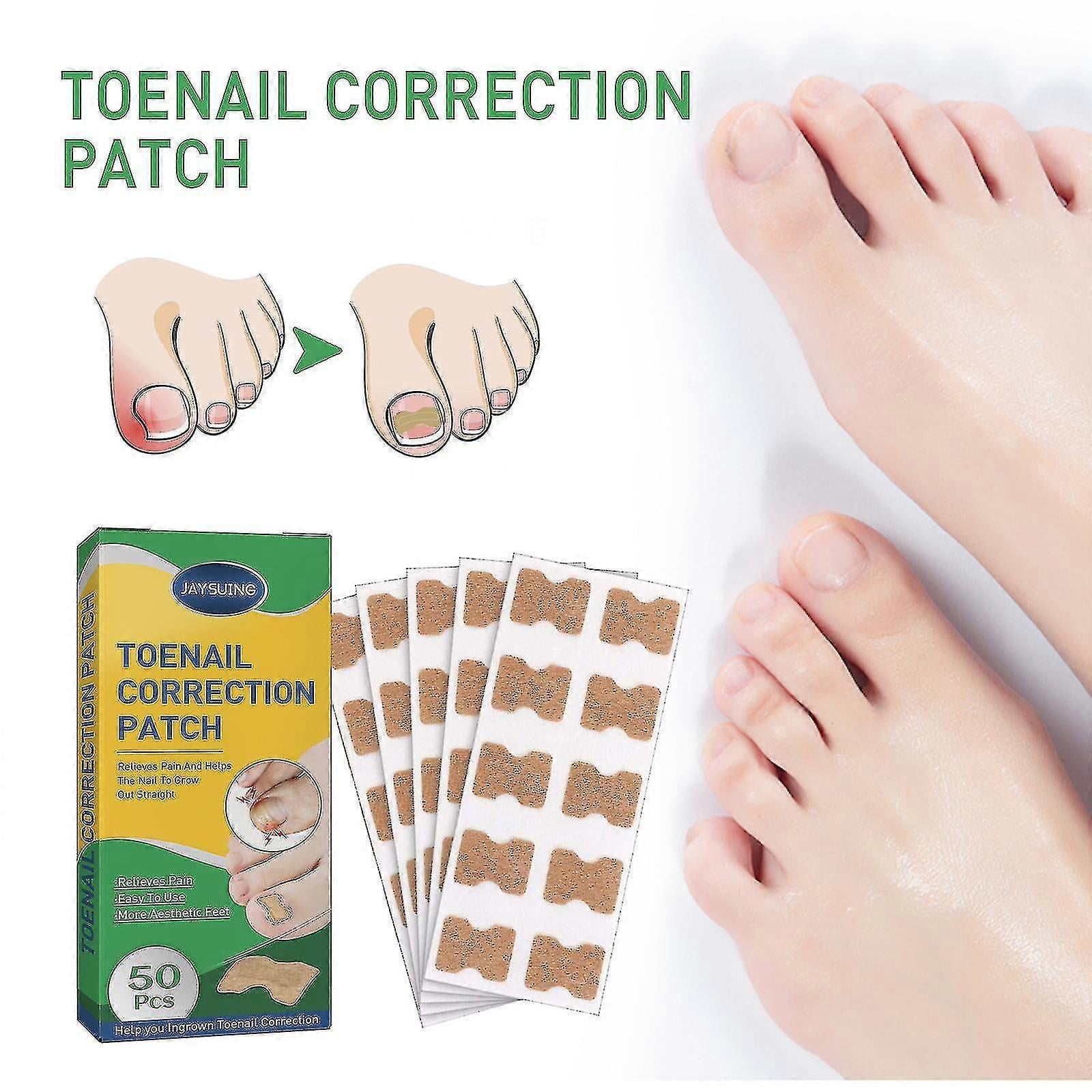 Jaysuing toenail groove correction stickers, manicure straightening ...