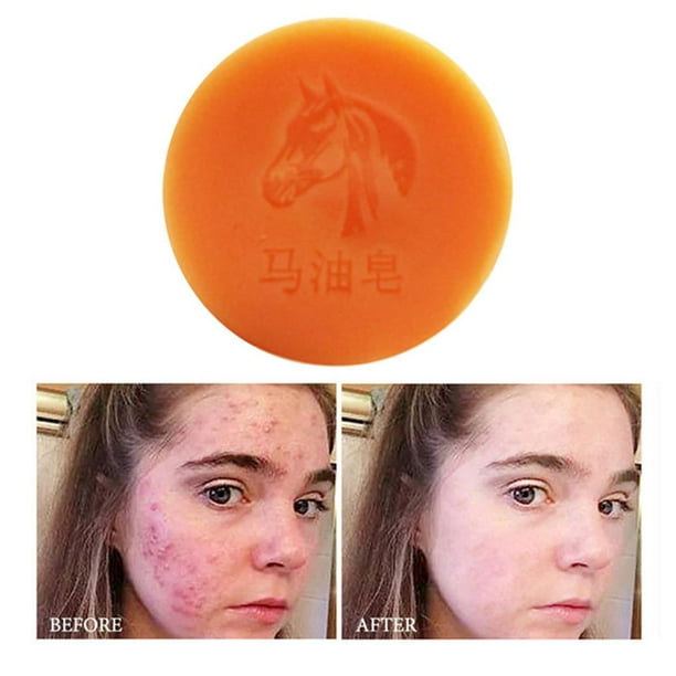 pitrice Horse Oil Soap Moisturizing Brighten Skin Color Pores Deep Soap ...