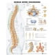 Human Spine Disorders Anatomical Chart - Walmart.com
