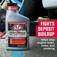 STP High Mileage Oil Treatment + Stop Leak - 15 fl oz - Walmart.com