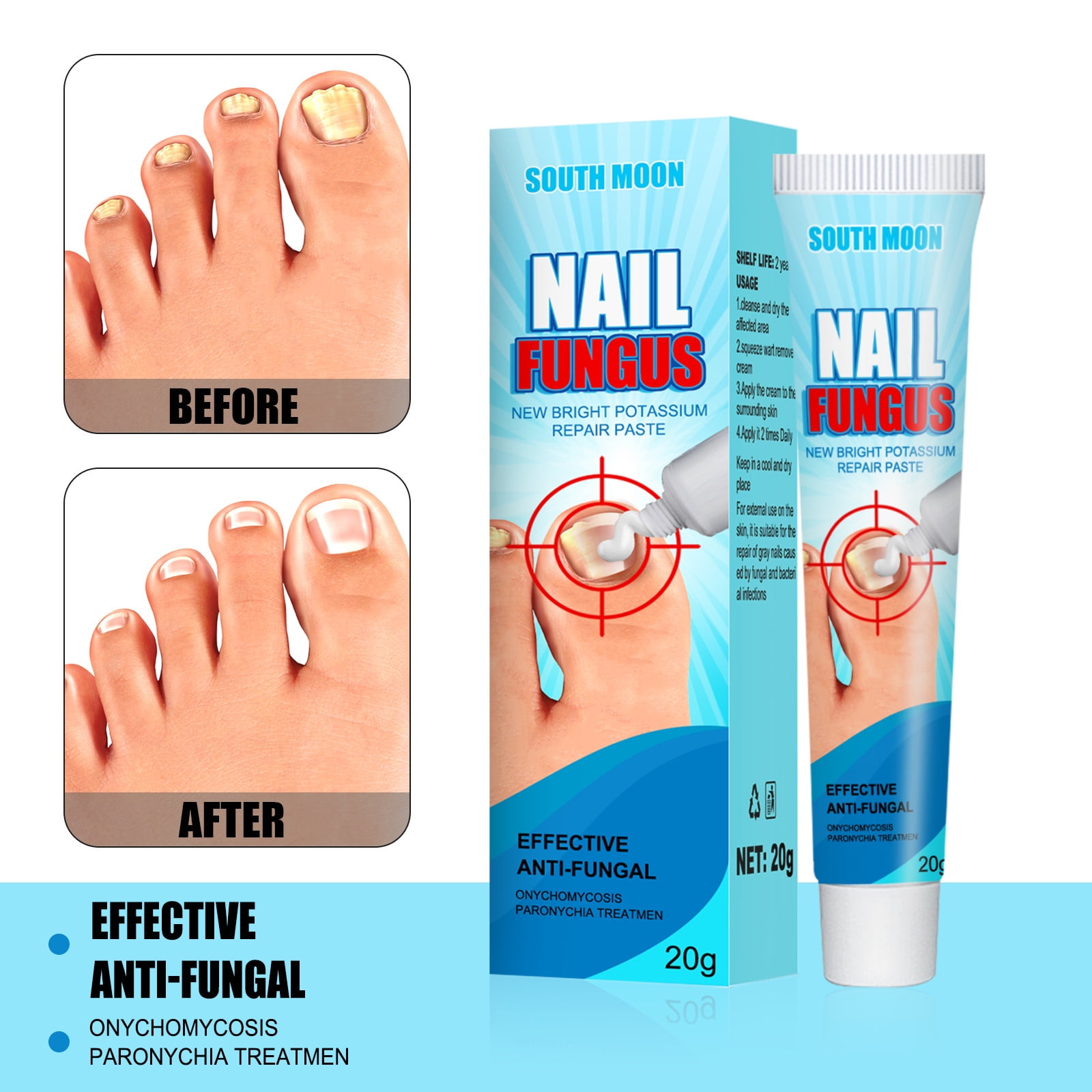 Buy Anti-Fungal Formula - Finger and Toe Fungus Treatment,Eliminate ...