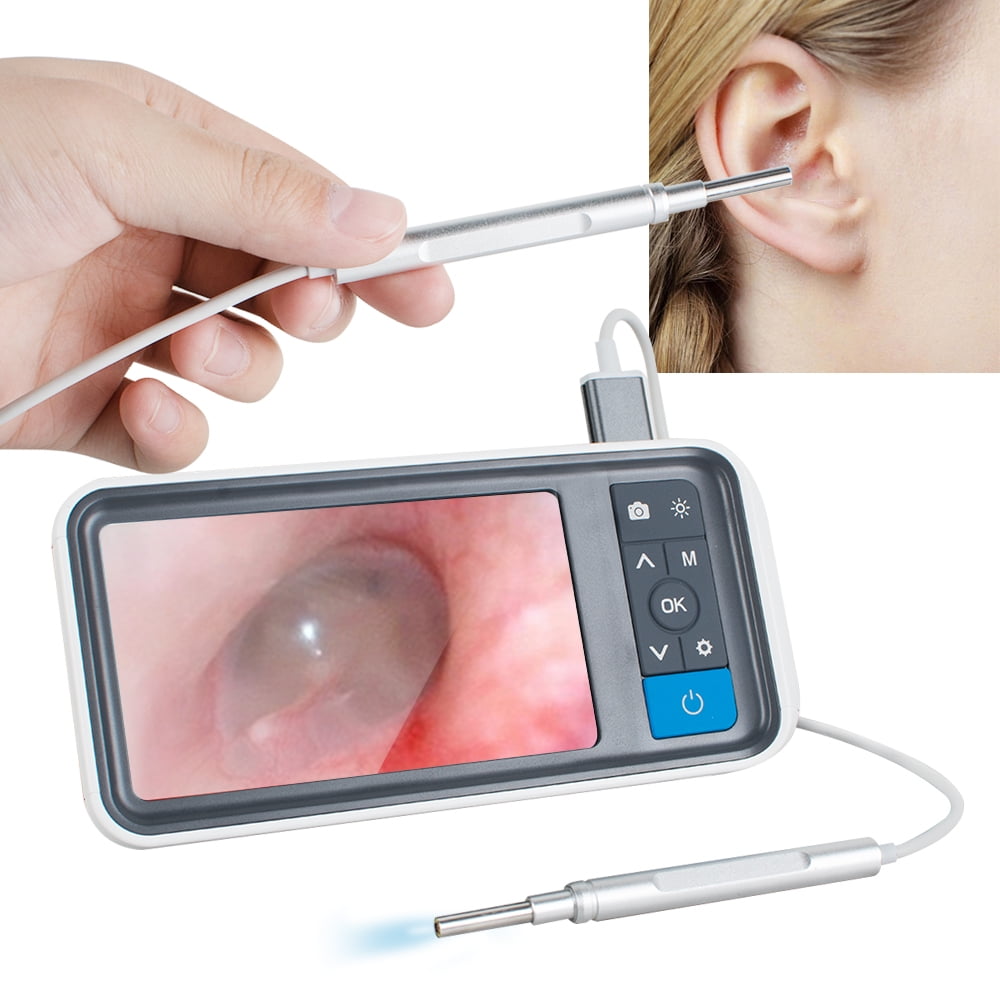 Rechargeable Digital Otoscope 3.9mm Lens Ear Inspection Camera 4.5 inch ...