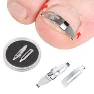 Ingrown Toenail Pain Reliever, 1 kit, (w/ Gel, 12 retainer rings & 12 ...