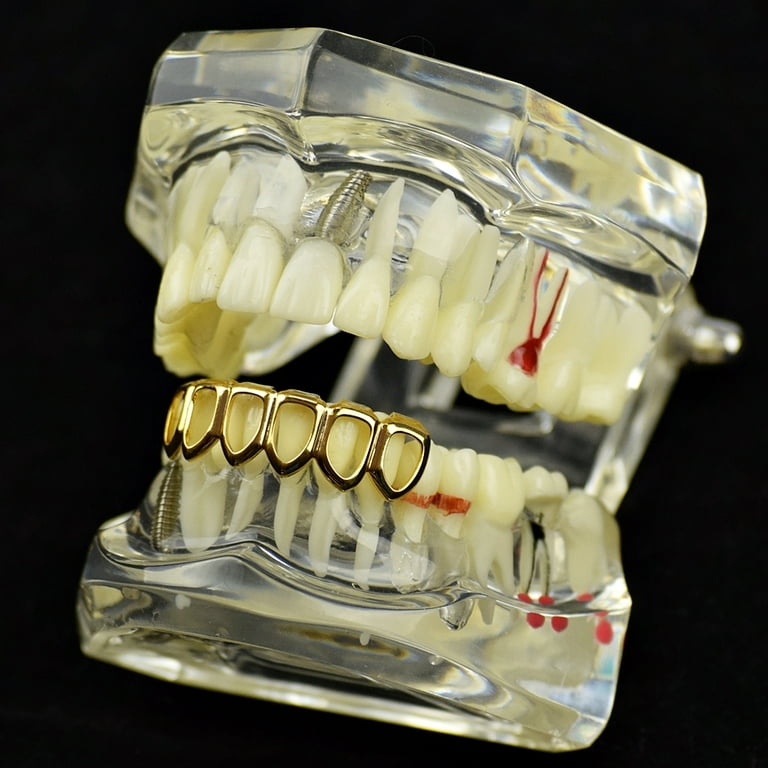Cheap Gold Fronts Teeth