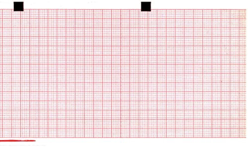 ECG Paper 80MM X 70MM X 300Sheets (Works for Schiller AT101, 2157026 ...