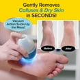 Pedi Vac Electric Callus Remover with Built-in Vacuum, Professional ...