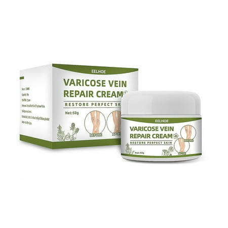 Varicose Veins Cream Eliminate Varicose Veins And Spider Veins,improve ...