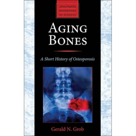 Aging Bones: A Short History of Osteoporosis (Johns Hopkins Biographies ...