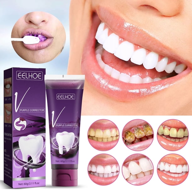 Dentifrice V34 pour le blanchiment des dents, violet, taches jaunes ...