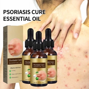 Dermveda Original Advanced Psoriasis & Seborrheic Dermatitis Cream ...