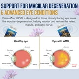 Vision Max 20/20 Eye Health Supplement – Lutein, Zeaxanthin, Saffron ...
