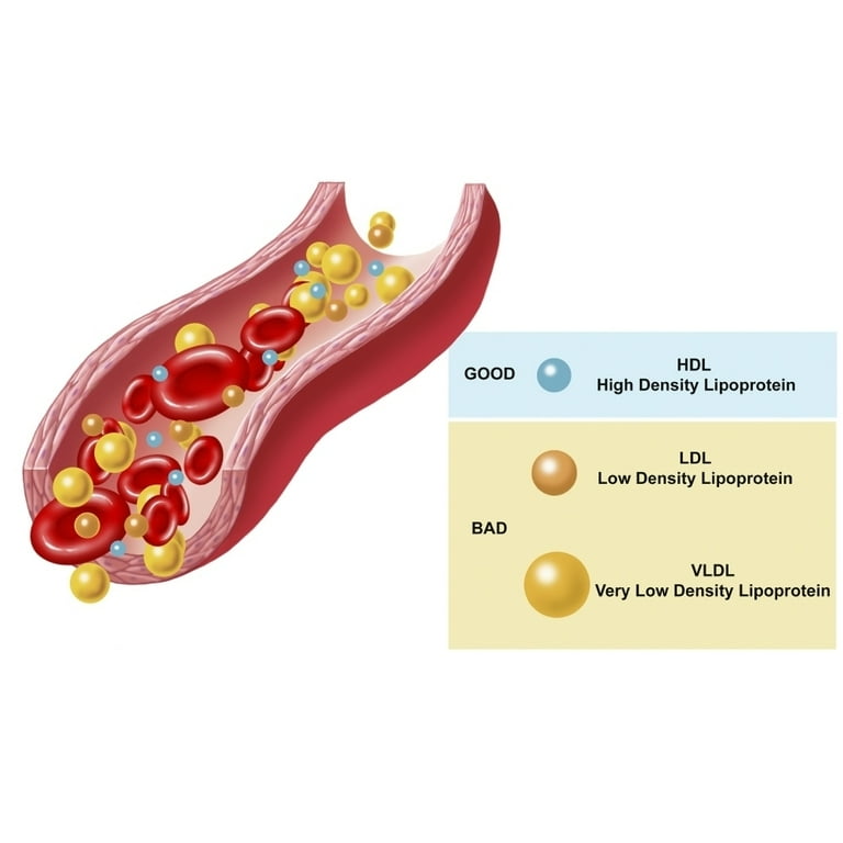 Cholesterol Posters