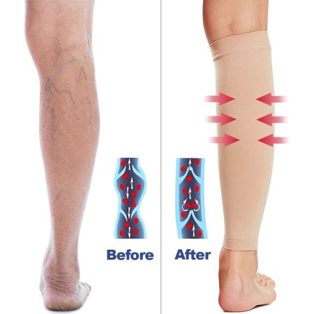 Beister 20-30 mmHg Graduated Calf Compression Sleeves for Women & Men ...