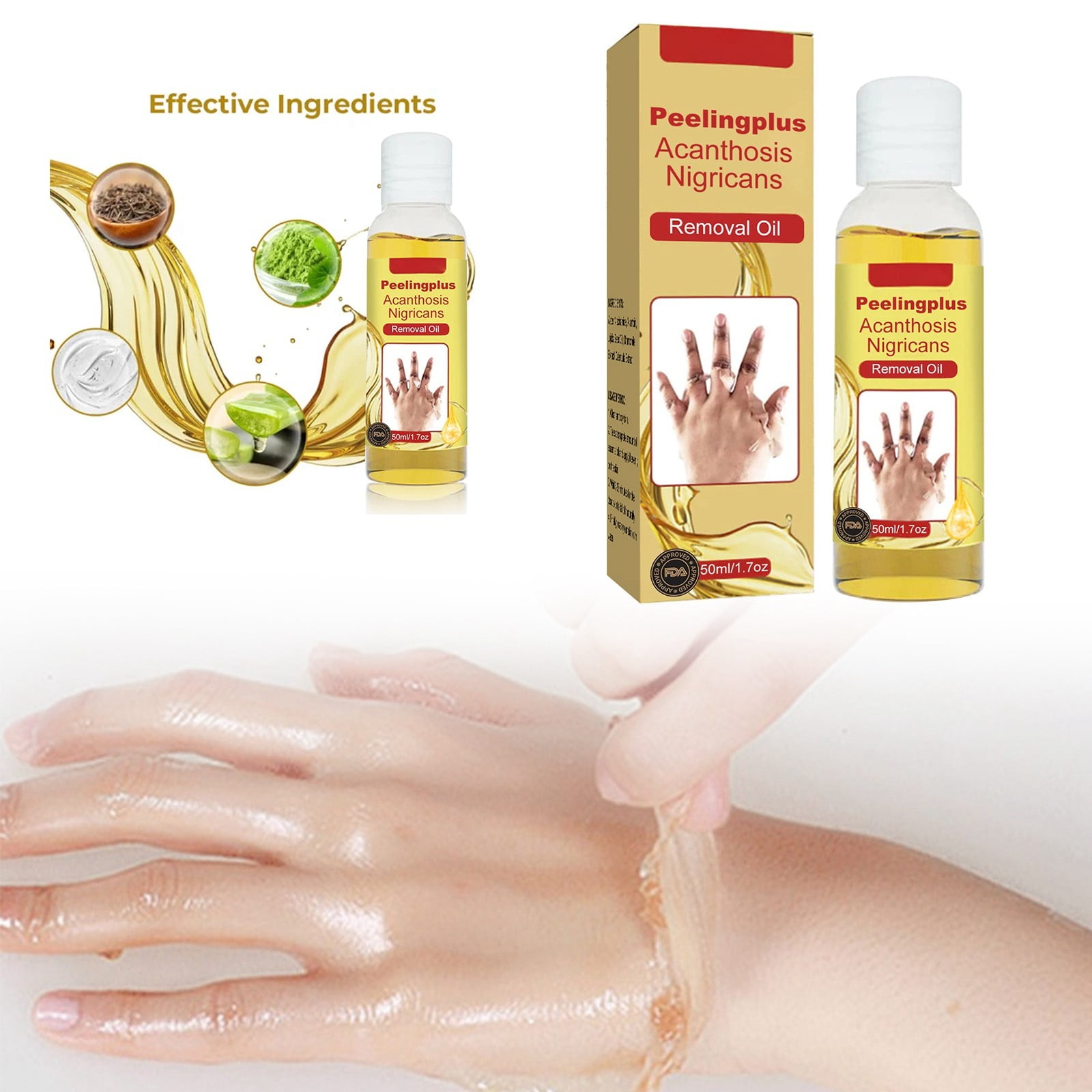 DHGDJGIN Keratosis Exfoliating Oil Underarms Knees Elbows Joints ...