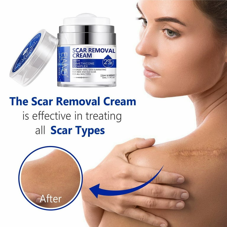 Acne Scars Removal Cream