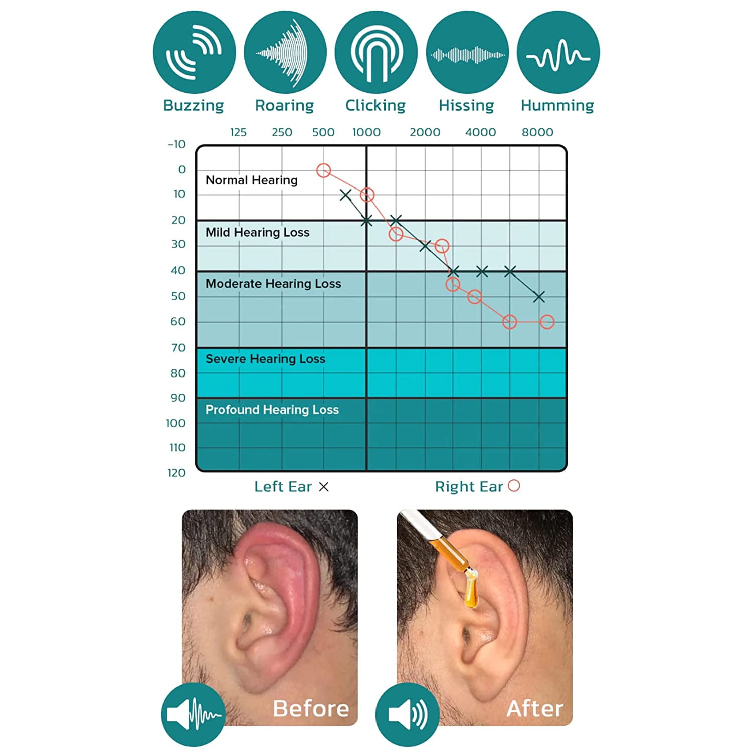 Temporary Loss Of Hearing And Ringing In One Ear | ppgbbe.intranet ...