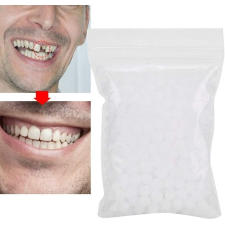 Temporary Tooth Repair Beads For Missing Tooth Filling Material With B ...
