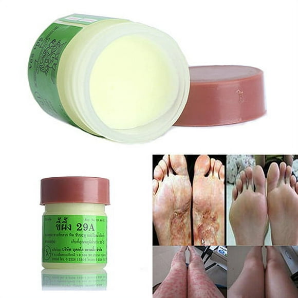 Ringworm Treatment Creams