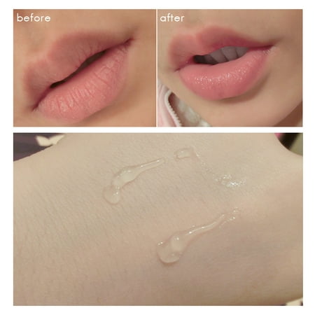 Propolis Lip Care Moisturizing Lip Gel 11.5g Propolis Lip Care ...