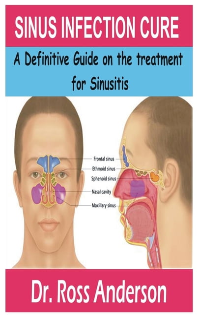 What Is Sinusitis And How Is It Caused Pharmacy Magazine