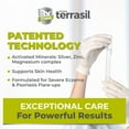 Terrasil Eczema & Psoriasis Ointment with Natural Activated Minerals 3X ...