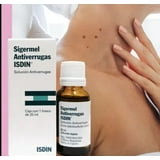 Sigermel Solución Tópica Isdin Sigermel Sigermel Antiverrugas | Walmart ...