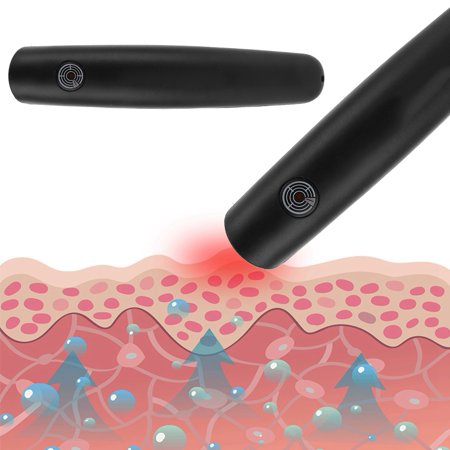Itching Relief Pen, Heat Vibration Deliver Low Power Consumption ...
