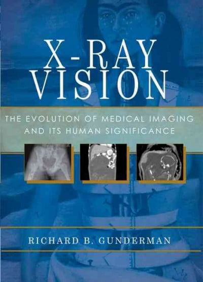 Pre-Owned X-Ray Vision: The Evolution of Medical Imaging and Its Human ...