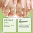 Ktlvex Toenail Fungus Treatmenttoenail Fungus Treatment Extra Strength30ml Nail Fungus