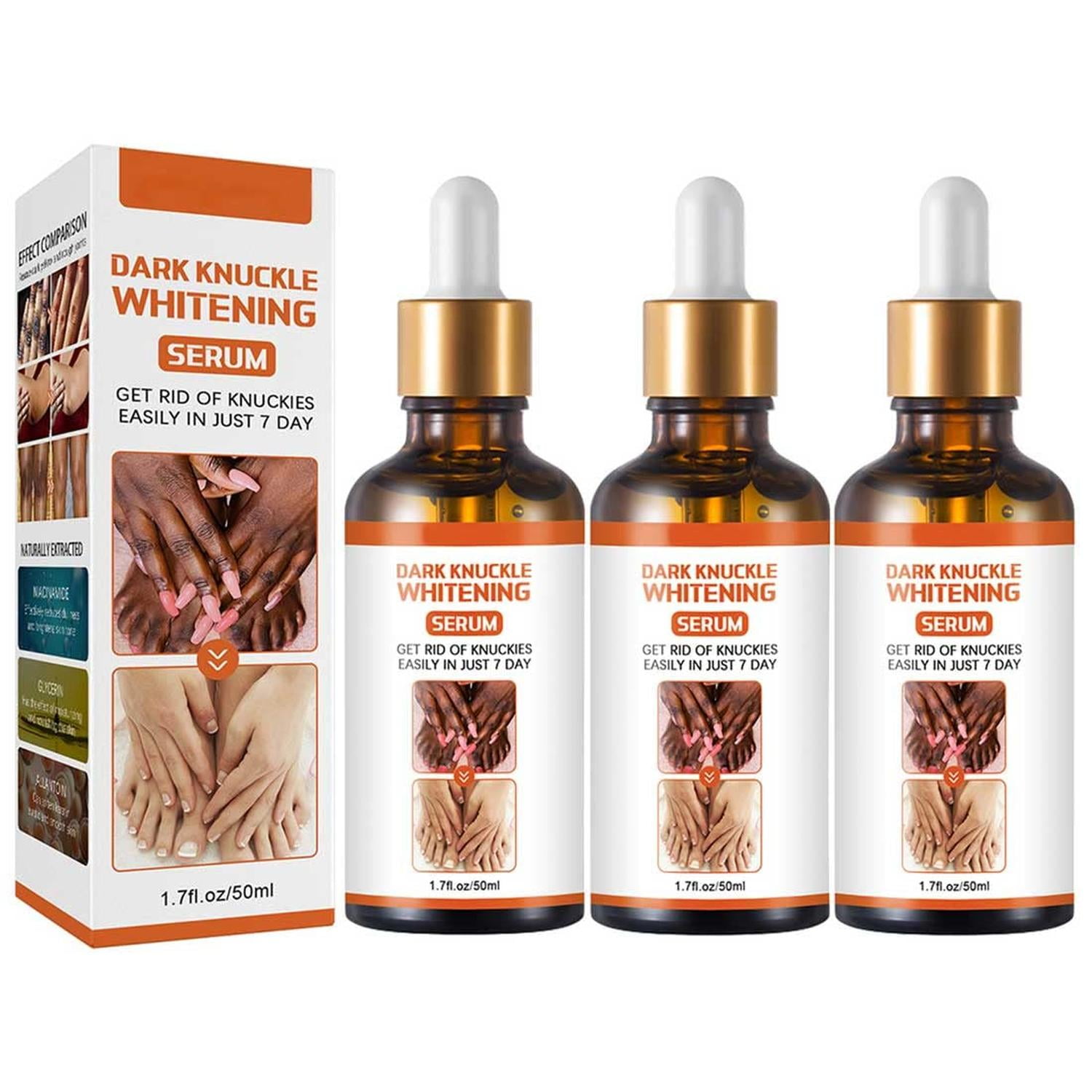 Serum for Dark Spots and Knuckles Whitening, Skin Lightening Oil for ...