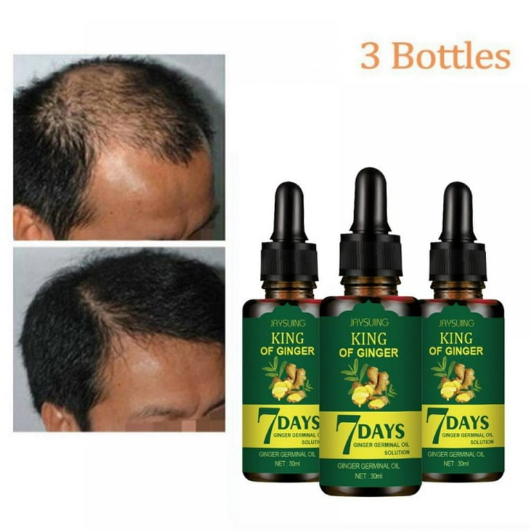 Hair Growth Medication | ppgbbe.intranet.biologia.ufrj.br