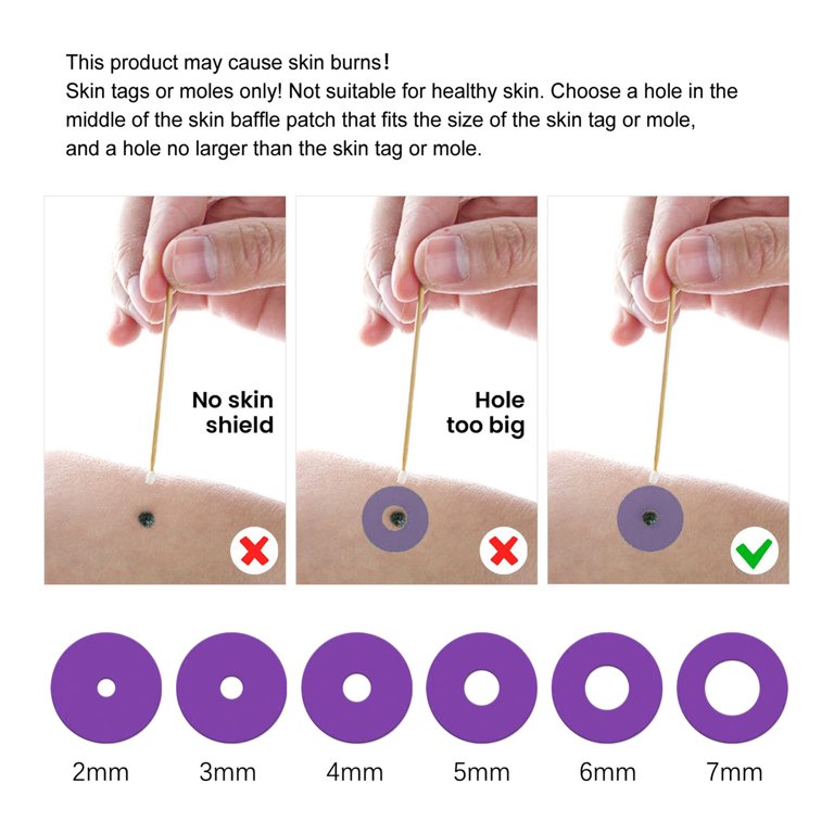 Skin Tag Remover Walmart Canada Cheapest Order | www.oceanproperty.co.th