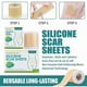 Silicone Scar Tape Removal Patch Acne Gel Scar Therapy Silicon Tape ...