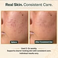 AMVital Turmeric Vitamin C Mask, Clay Mask for Detoxifying, Hydrating ...