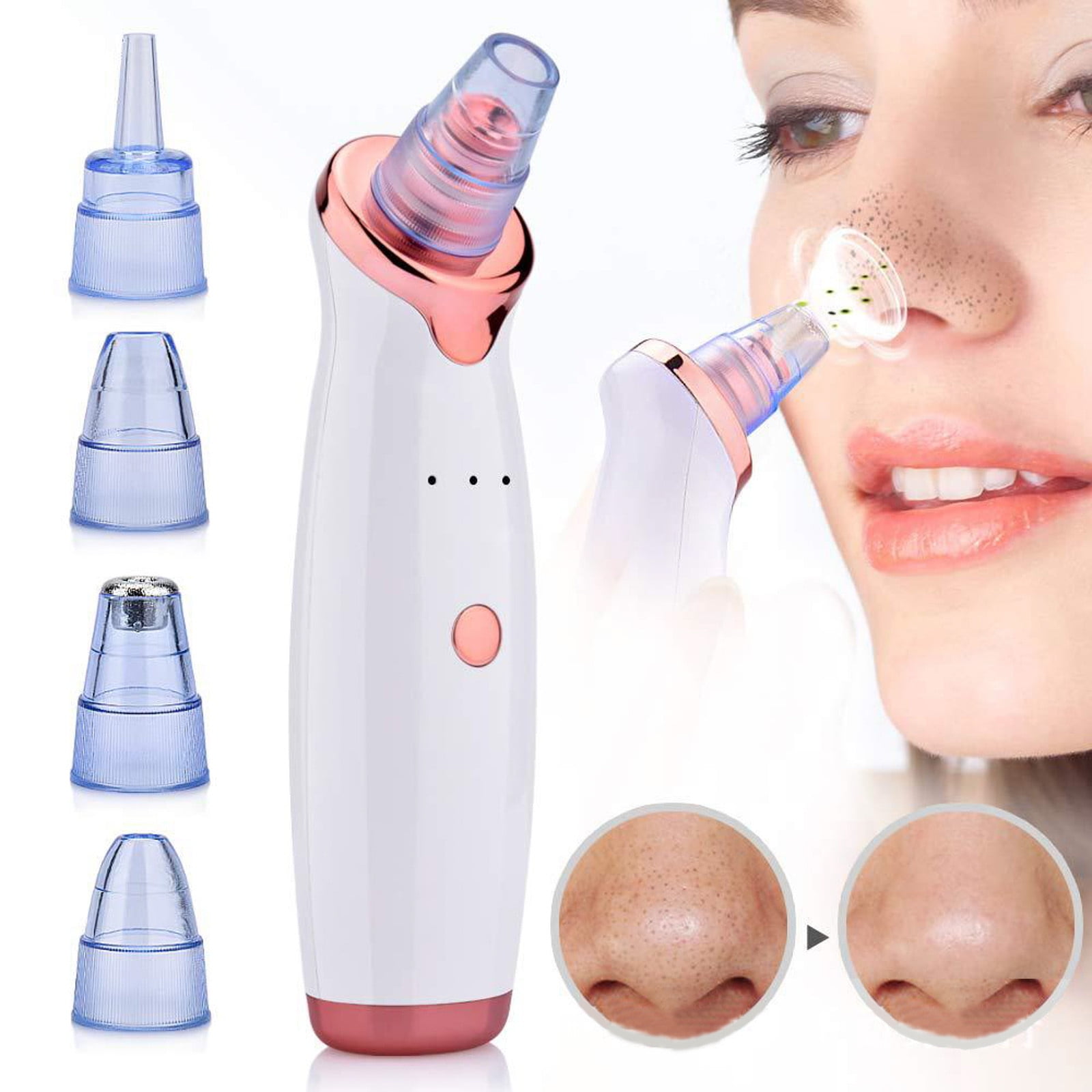 Click here for Cyc Electric Blackhead Remover Pore Vacuum Suction... prices