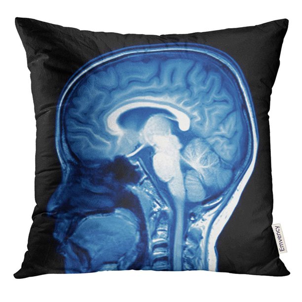 USART Scan Magnetic Resonance MRI of The Brain Xray Pillow Case 16x16 ...