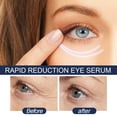 PiGOGI Fast Reduction Eye Serum 5g, Advanced formulas Slow Aging Serum ...
