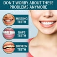 EELHOE Snap on Veneers Teeth Cosmetic Upper Lower Temporary Tooth ... EELHOE Snap on Veneers Teeth Cosmetic Upper Lower Temporary Tooth ...