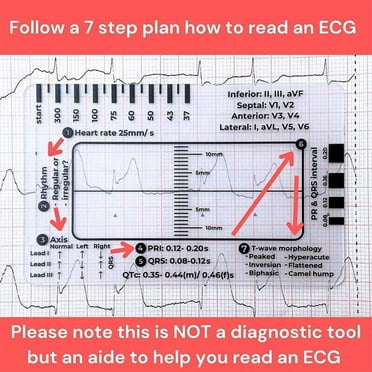 2pcs ECG 7 Step Ruler - Plastic Measuring Tool for EKG Interpretation - Walmart.com