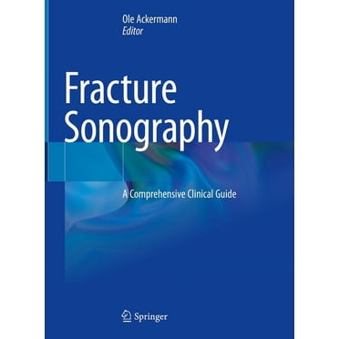 Pre-Owned Ambulatory Phlebectory: A Practical Guide to Stab Avulsion ...