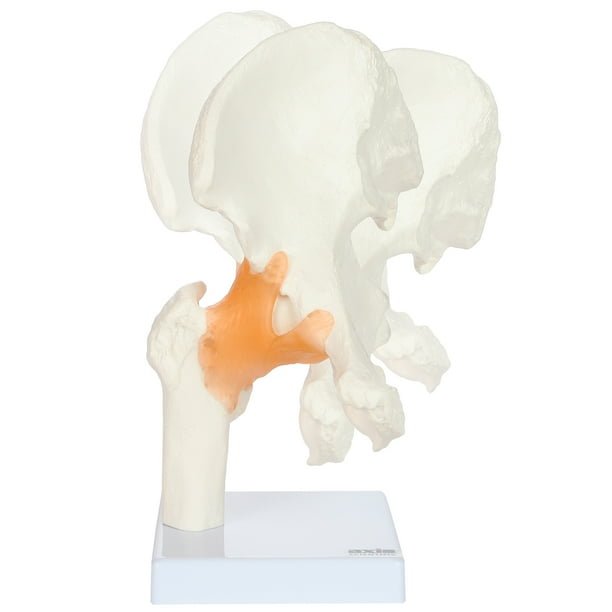 Axis Scientific Life Size Hip Bone Model – Premium Hip Joint Model with ...